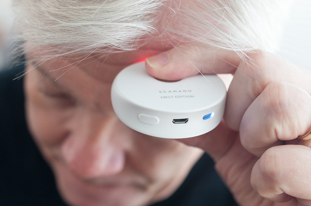 Scanadu Scout | Tech Everywhere