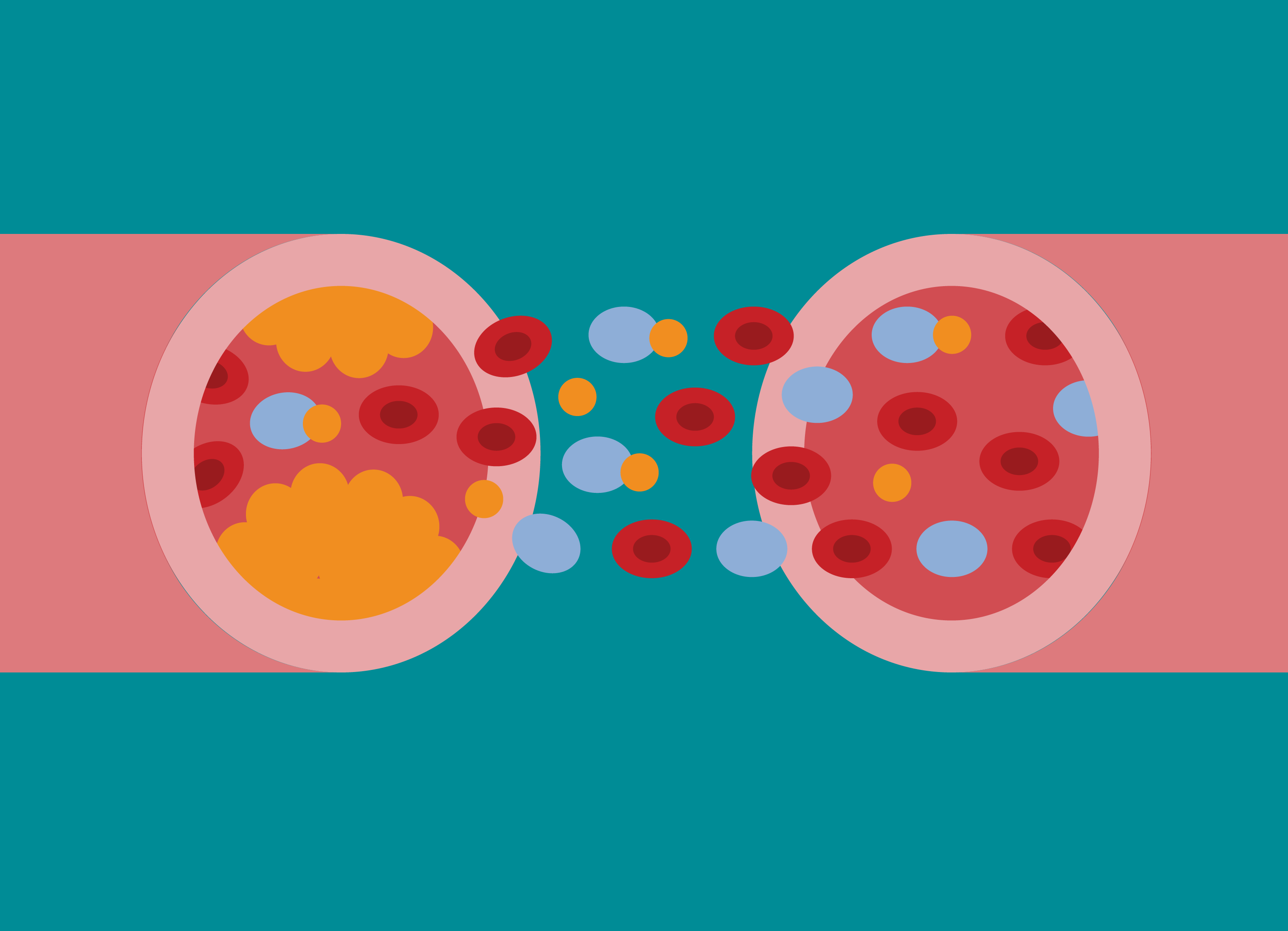 What Are Cholesterol and Triglycerides?